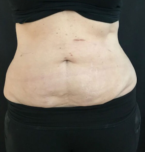 Neurotris Microcurrent | Body Treatment | Santa Cruz